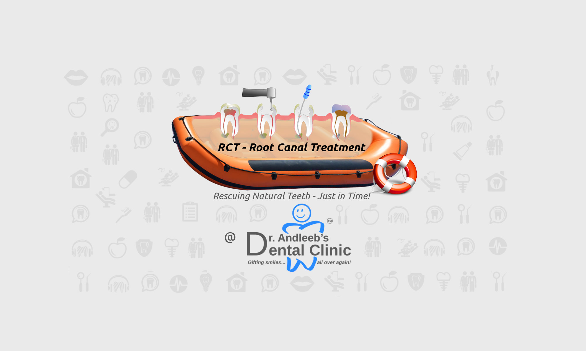 RCT – Root Canal Treatment